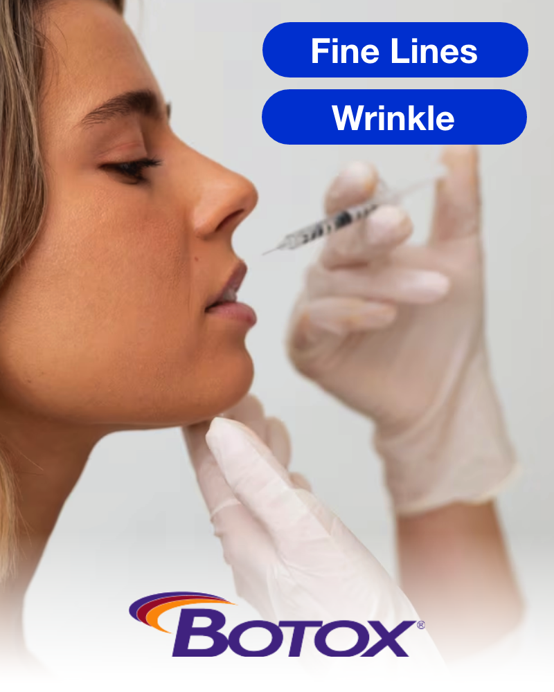 Service - Botox 20 Units Appointment Voucher – TMS Online Store
