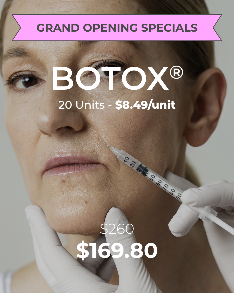 Service Voucher - Botox 20 Units – TMS Online Store